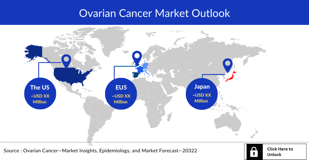Ovarian Cancer Market Size, Share | Ovarian Cancer Market Report ...