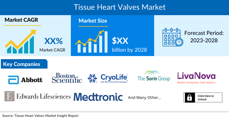 Tissue Heart Valves Market Size, Share, Devices, Companies