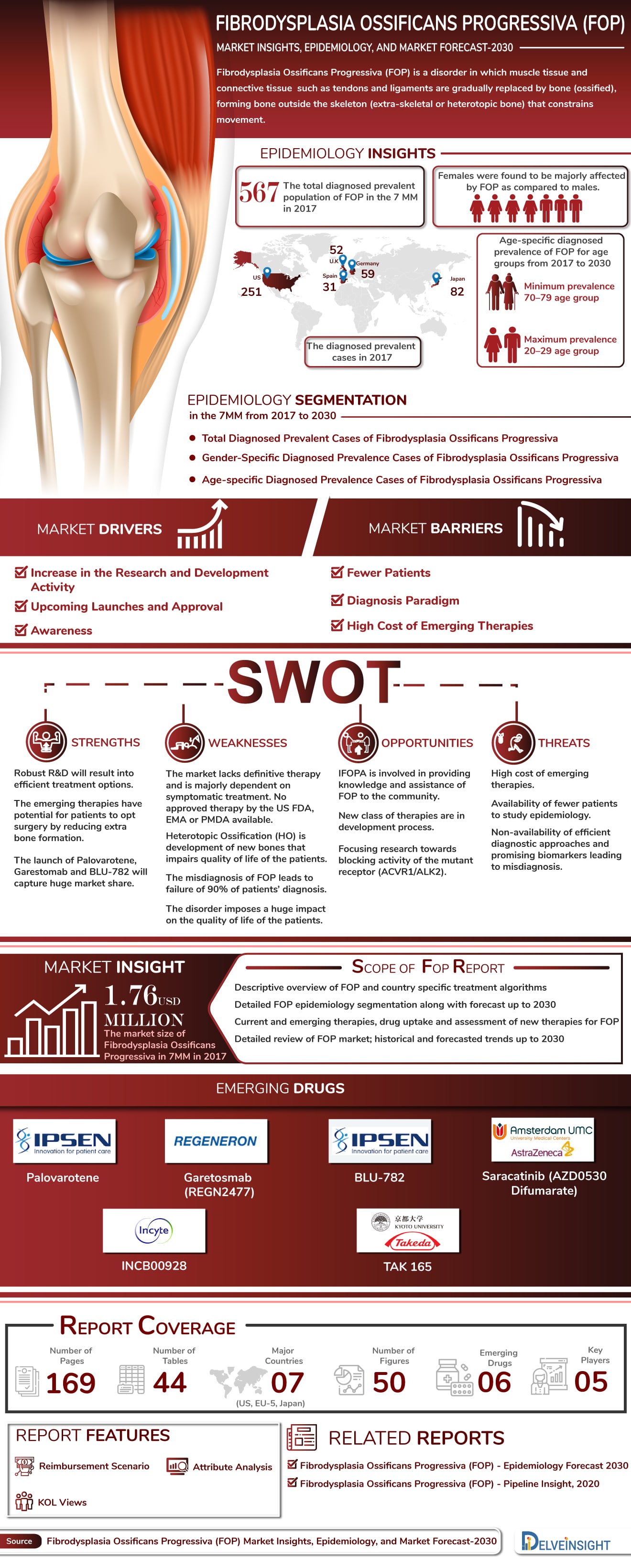 Fibrodysplasia Ossificans Progressiva (FOP) Treatment, Companies ...